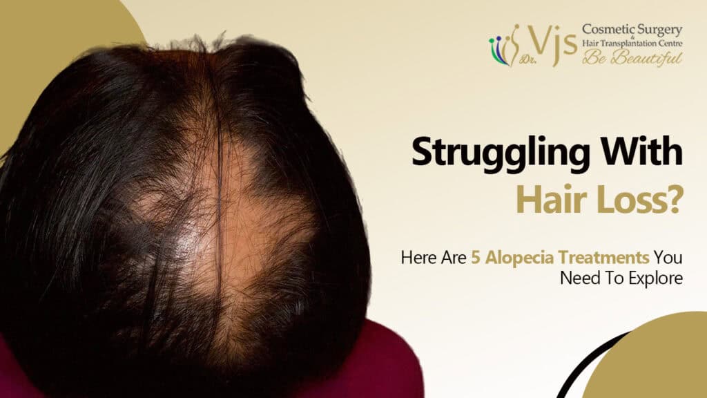 What Is Hair Loss And Alopecia?