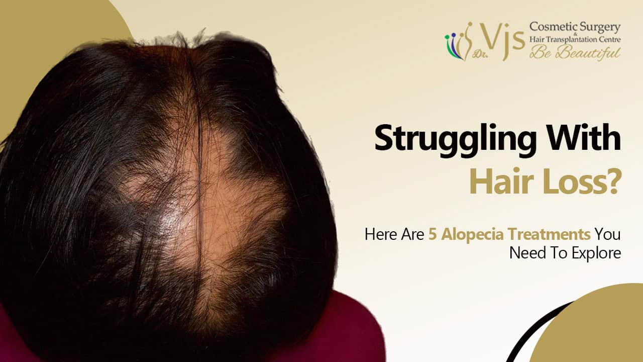 Struggling With Hair Loss? Here Are 5 Alopecia Treatments You Need To ...